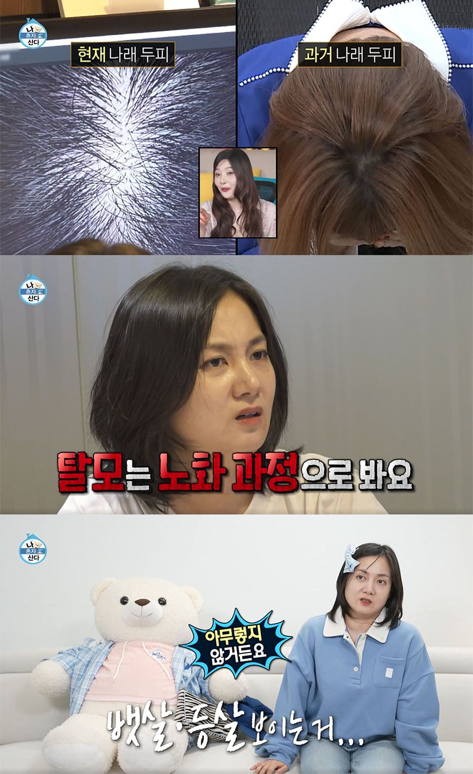 Park Na-rae's Hair Loss Surprise Shocks Cast on 'I Live Alone'—"The ...