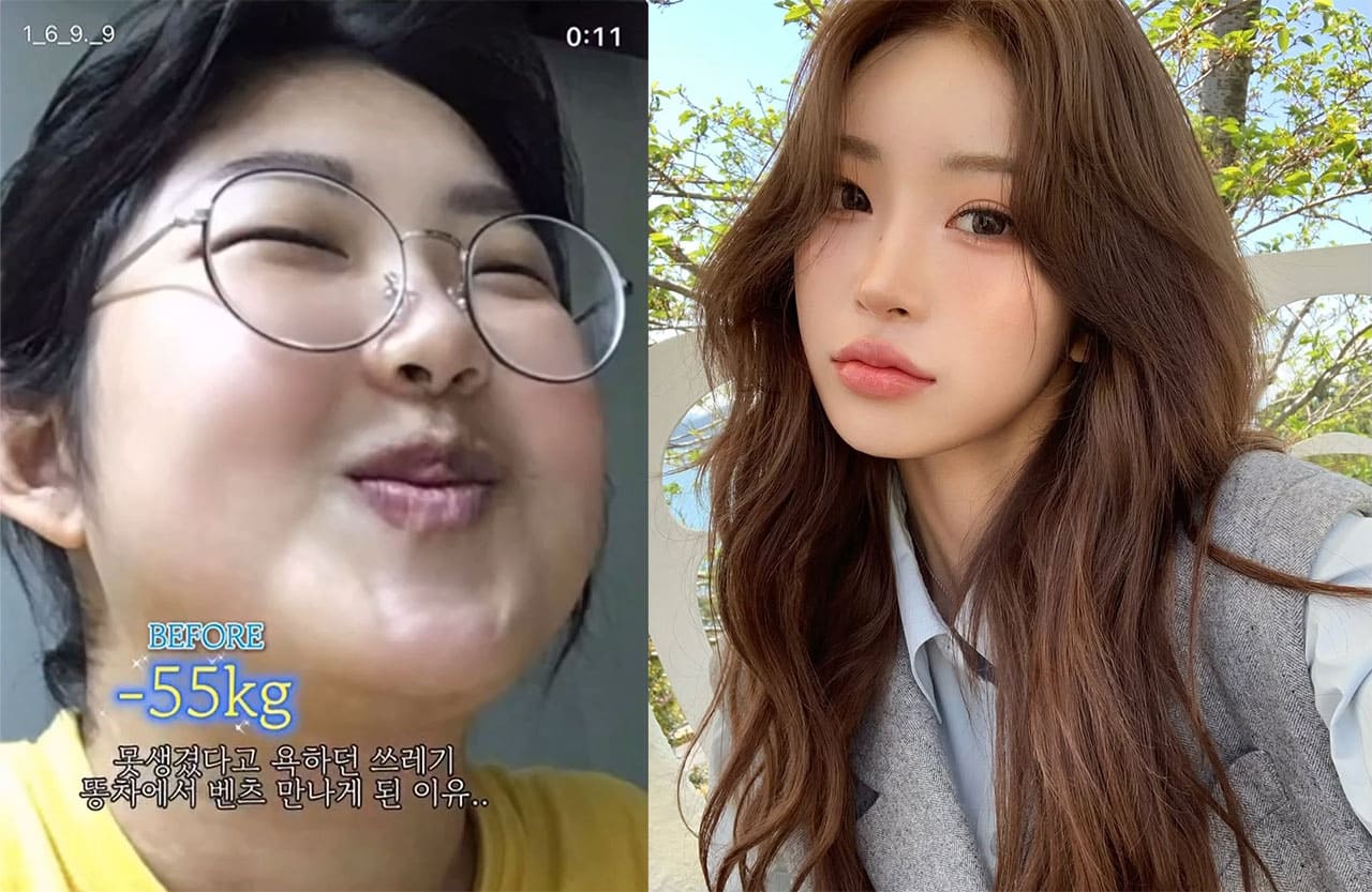 Choi Jun-hee Opens Up About Past Dating Abuse and Shares Empowering Message on Self-Worth